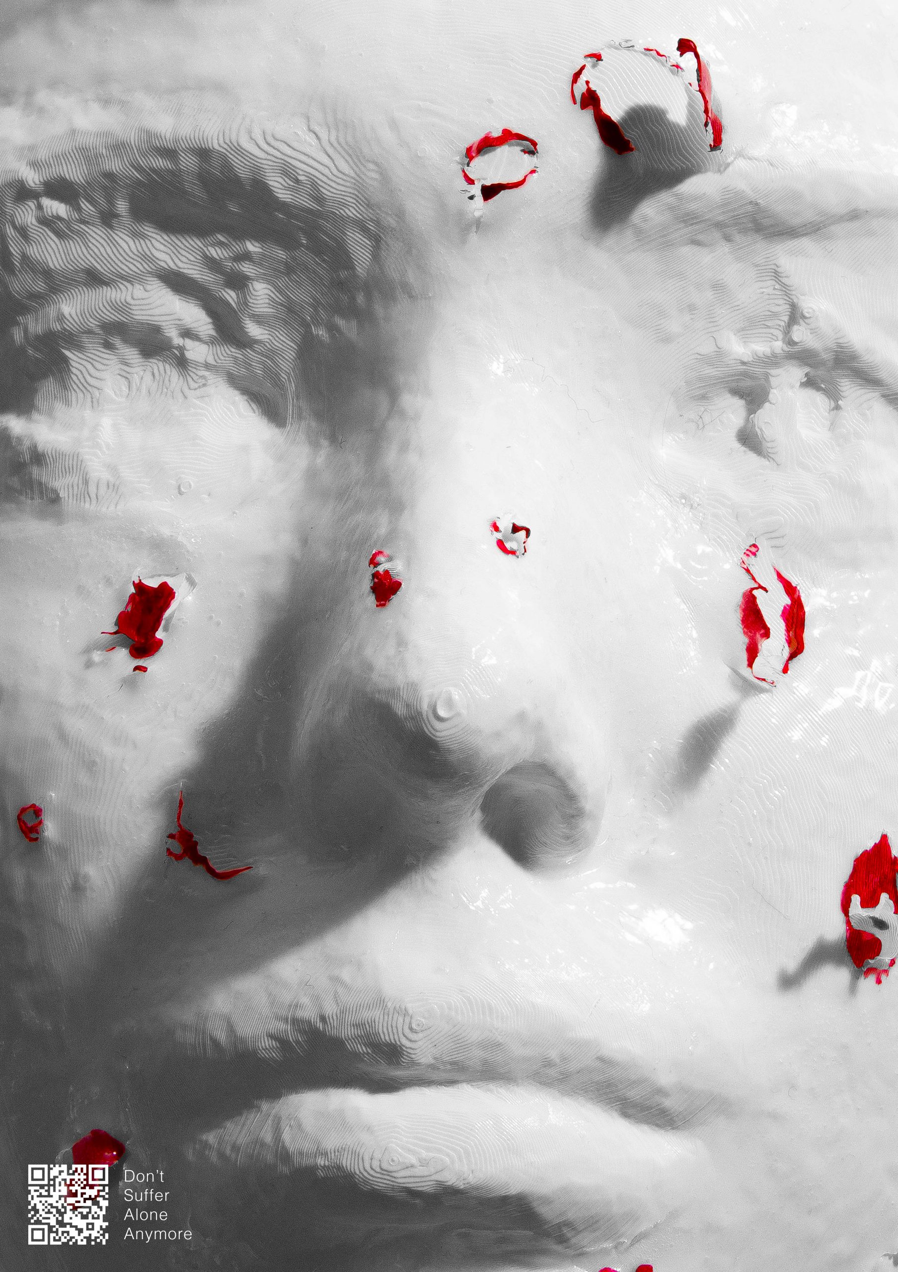 Skin Picking Disorder - Body Dysmorphic Disorder Foundation YOUTH